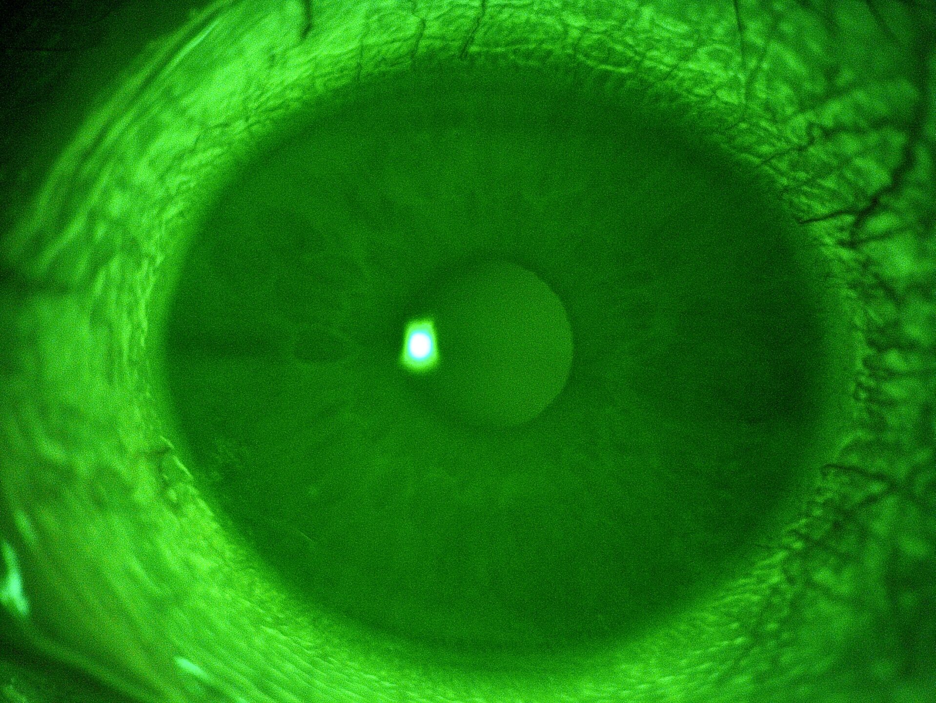 Putting the Latest Soft Contact Lens Research to Practice - Contamac