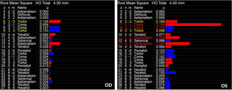 Haunted by Ghosting: HOA Correction in Keratoconus - Contamac