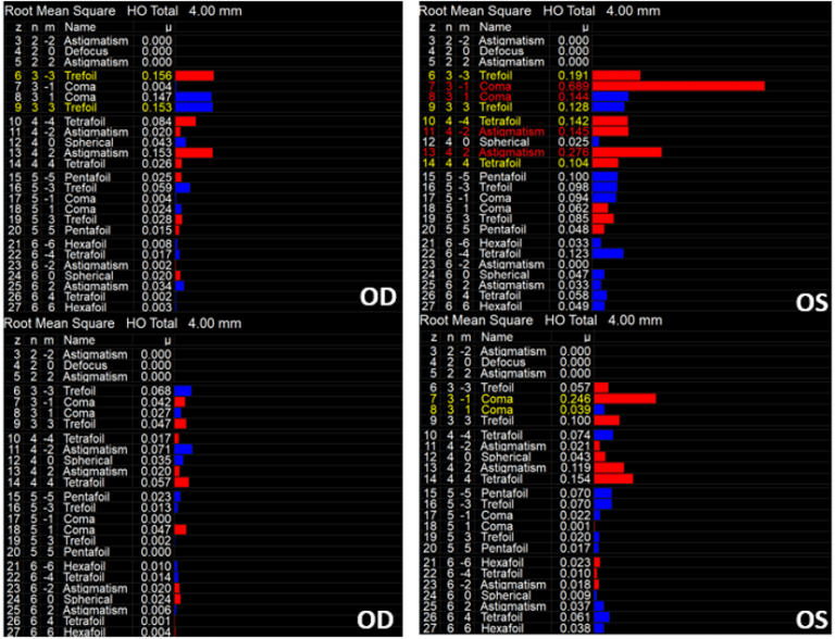 Haunted by Ghosting: HOA Correction in Keratoconus - Contamac
